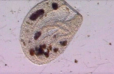 Bursaria (Protozoan) Videos | Nikon’s MicroscopyU