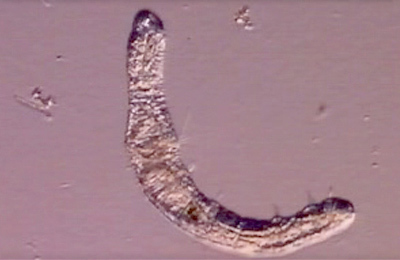 Chaetogaster (Annelida) Videos | Nikon’s MicroscopyU