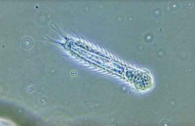 Chaetonotus (Gastrotricha) Videos | Nikon’s MicroscopyU