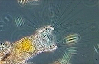 Collotheca (Rotifera) | Nikon’s MicroscopyU
