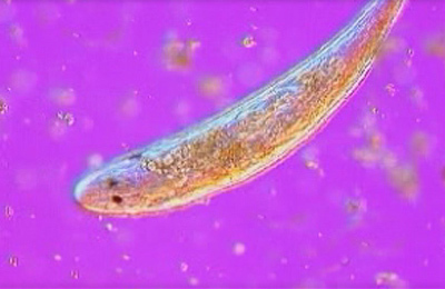 Dalyellia (Platyhelminthes) Videos | Nikon’s MicroscopyU