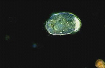 Metopus (Protozoan) Videos | Nikon’s MicroscopyU