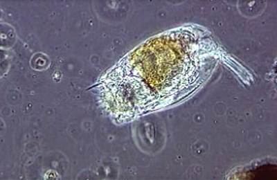 Mytilina (Rotifera) Videos | Nikon’s MicroscopyU