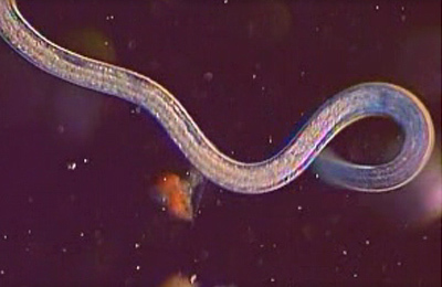 Nematode Worm (Nematoda) Videos | Nikon’s MicroscopyU