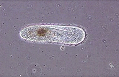 Paramecium (Protozoan) Videos | Nikon’s MicroscopyU