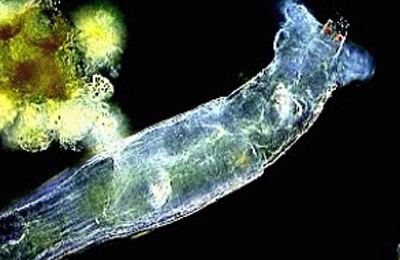 Philodina (Rotifera) Videos | Nikon’s MicroscopyU