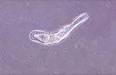 Spirostomum (Protozoan) Videos | Nikon’s MicroscopyU