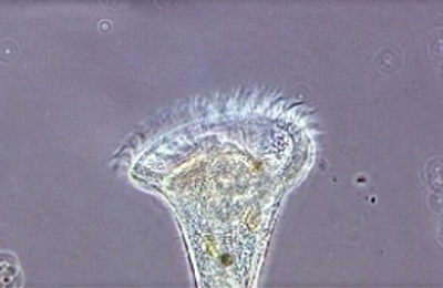 Stentor (Protozoan) Videos | Nikon’s MicroscopyU