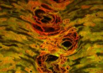 Primate Meissner’s Corpuscles | Nikon’s MicroscopyU