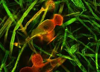 Rhizopus Rot | Nikon’s MicroscopyU