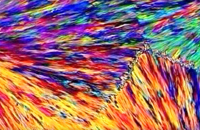 Cholesterol Videos | Nikon’s MicroscopyU