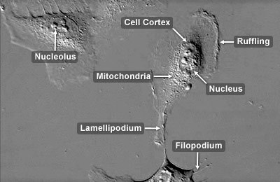 Human Bone Osteosarcoma Epithelial Cells (U2OS Line) | Nikon’s MicroscopyU