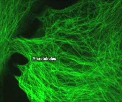 Gray Fox Lung Fibroblast Cells Expressing mEGFP-Tubulin | Nikon’s ...