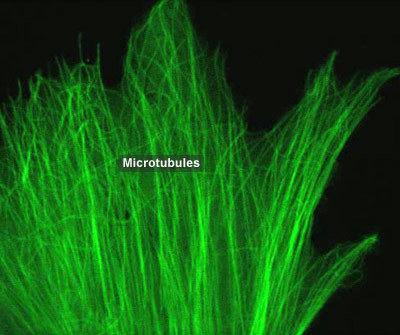 Exploring Tubulin Dynamics in Fibroblast Cells | Nikon’s MicroscopyU