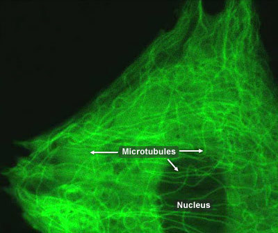 Tubulin Dynamics in Fox Lung Cells | Nikon’s MicroscopyU