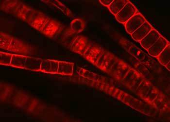 Ulothrix Under Microscope Labeled