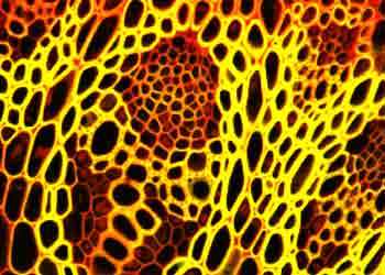 Wheat Rust | Nikon’s MicroscopyU