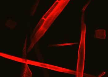 Wood Cells | Nikon’s MicroscopyU