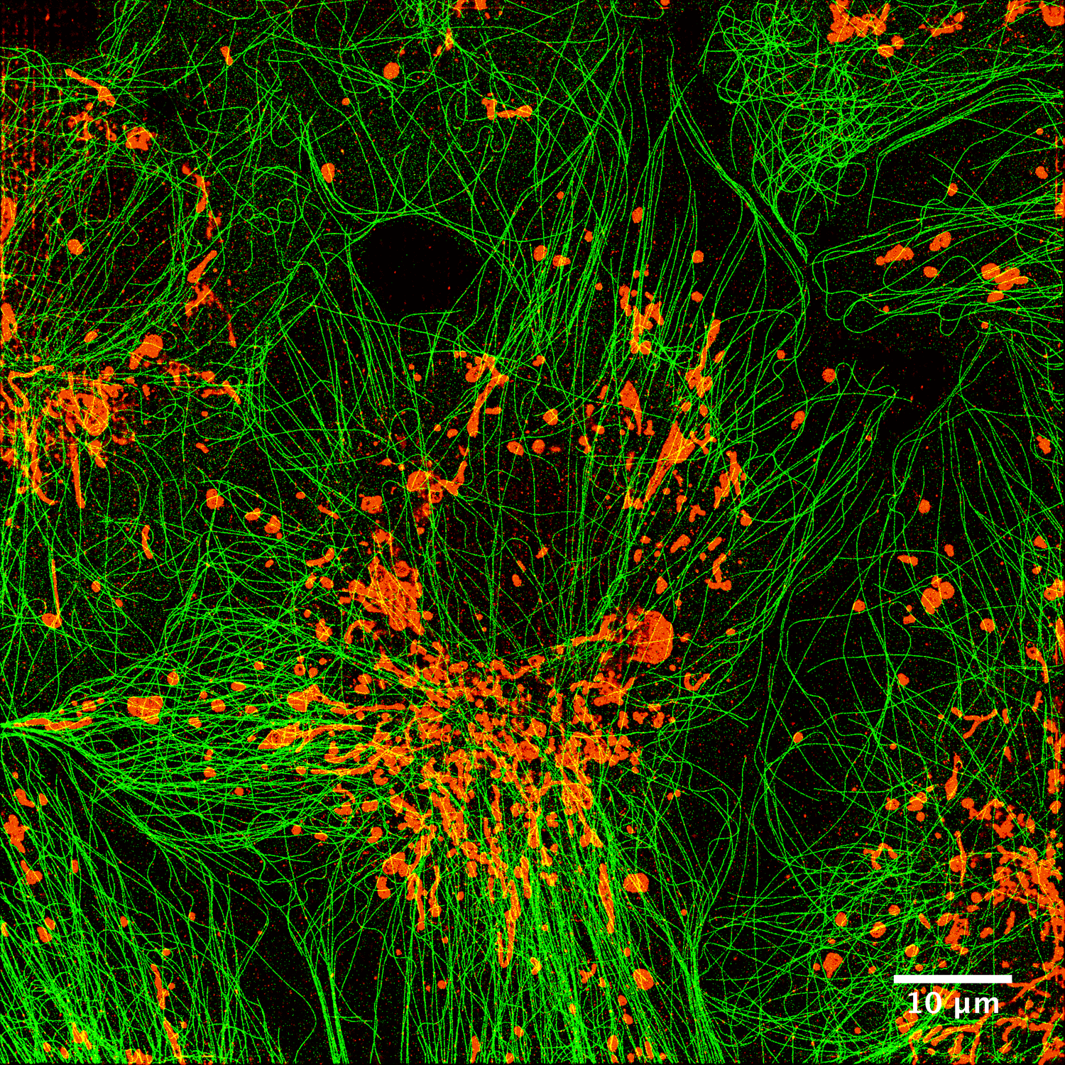 Nikon Single Molecule Imaging Contest Winners | Nikon’s MicroscopyU
