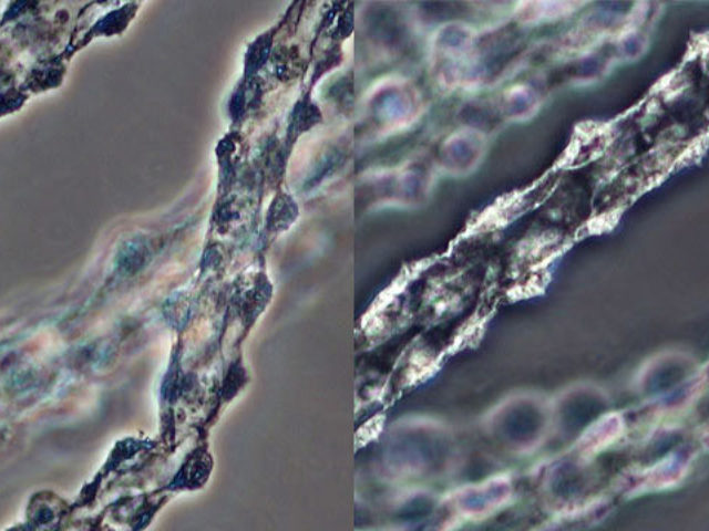 Phase Contrast | Nikon’s MicroscopyU