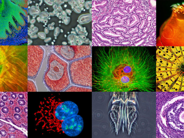 Digital Image and Video Galleries | Nikon’s MicroscopyU